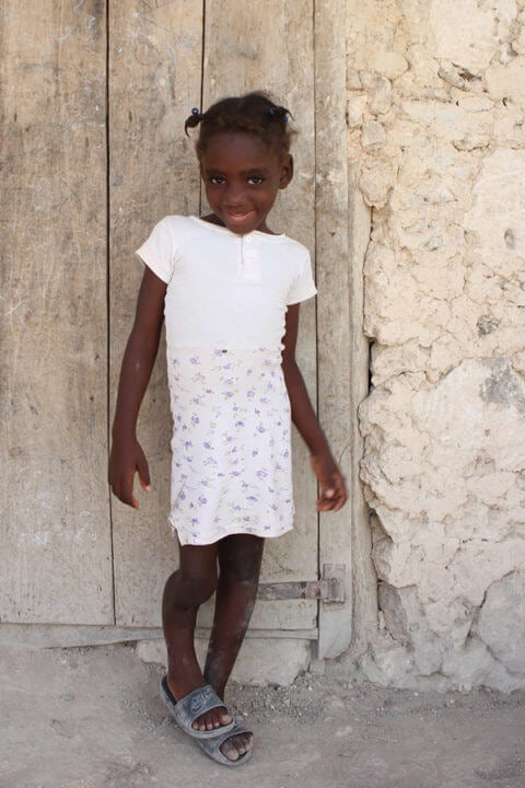 A Deformed Leg, Surgery, And Hope